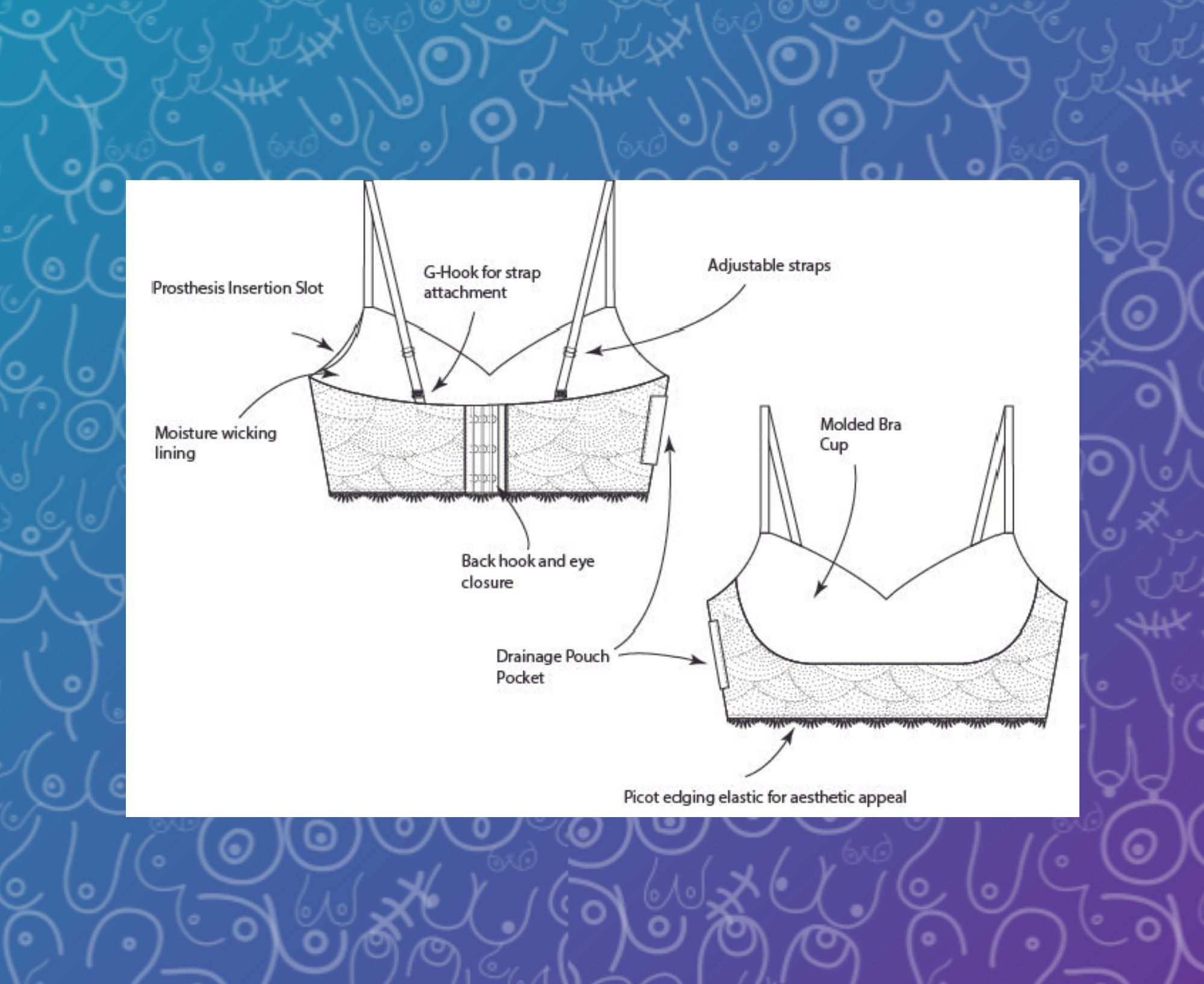 HUE Lab partners with St. Michael's Hospital for Surgical Bra Redesign ...
